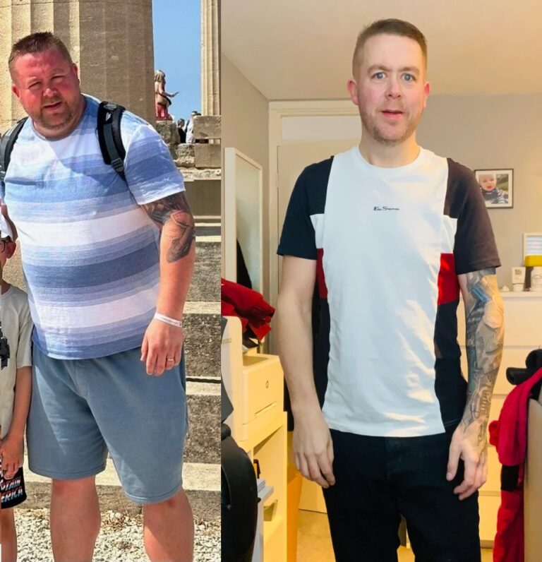 51 GLP-1 Photos Before And After: Real Patient Results And ...