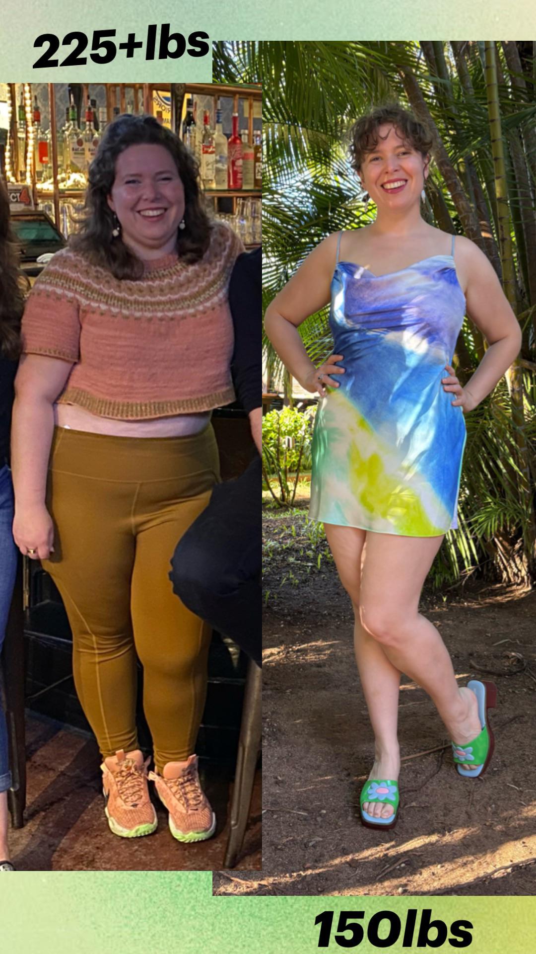 51 GLP-1 Photos Before And After: Real Patient Results And ...