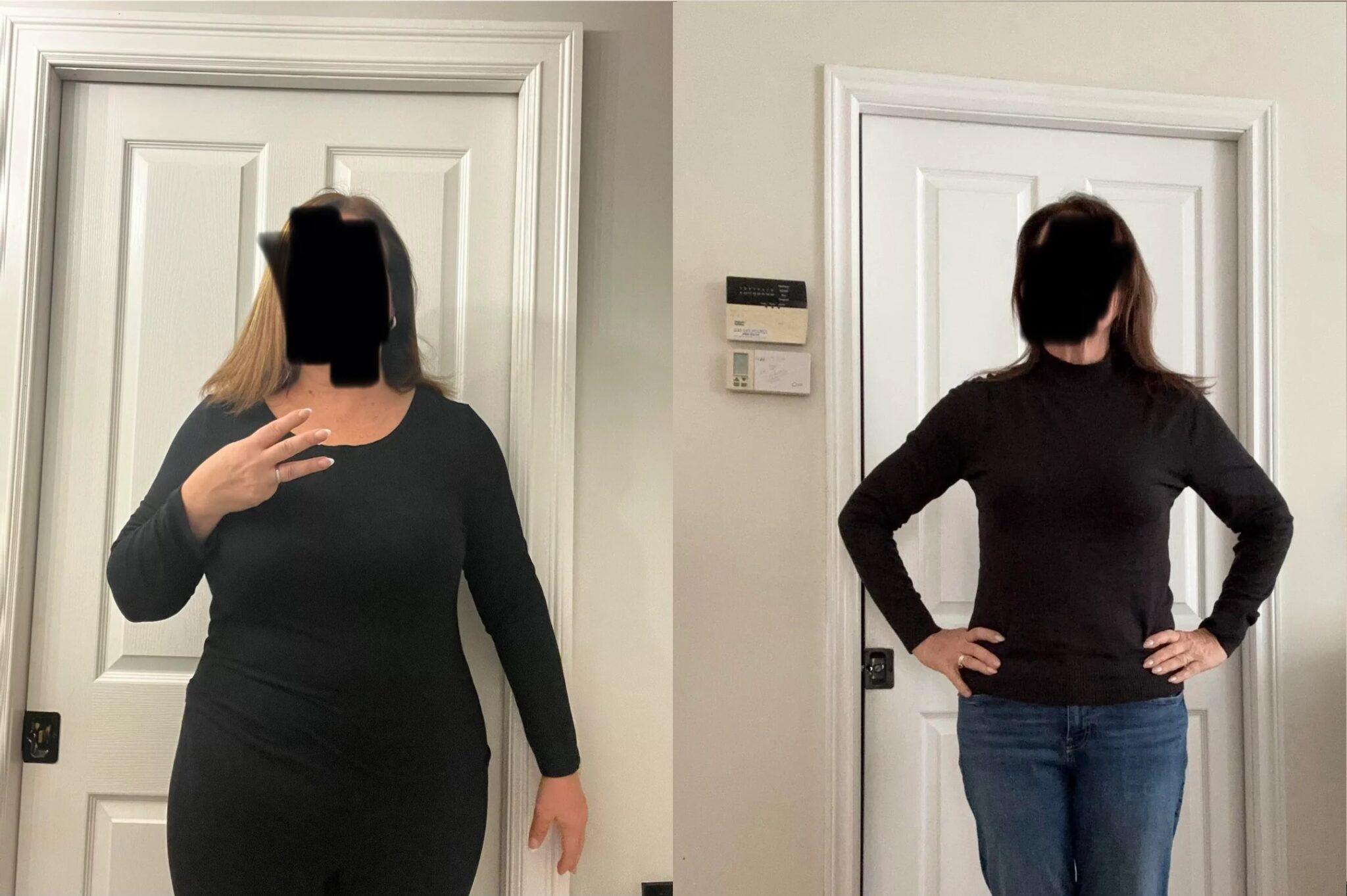 51 GLP-1 Photos Before And After: Real Patient Results And ...