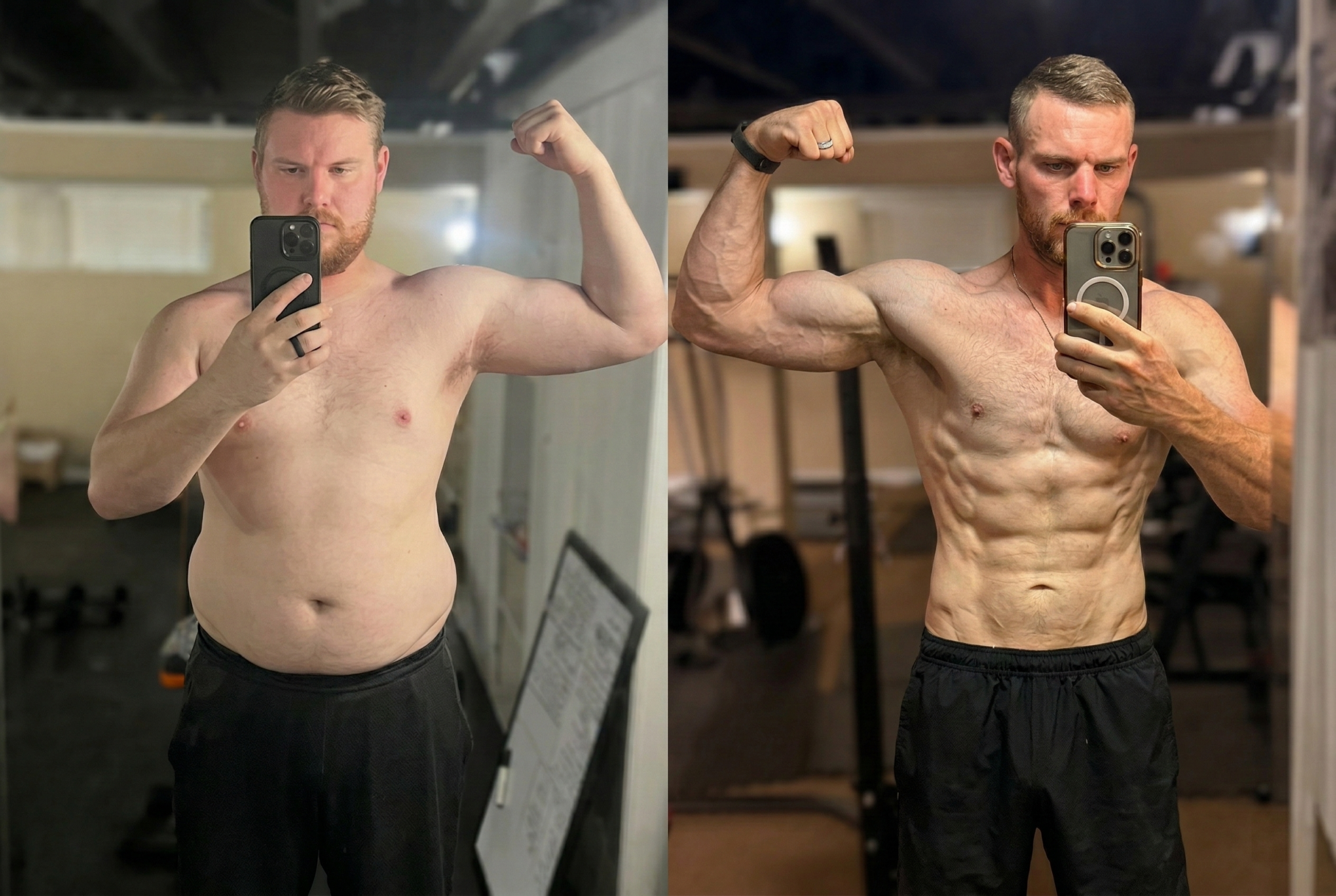 51 GLP-1 Photos Before And After: Real Patient Results And ...